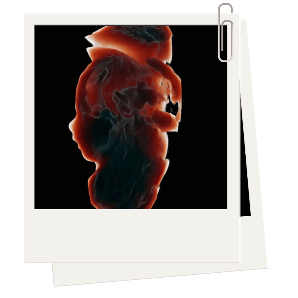 Growth Scan – Insta Scan 4d Baby